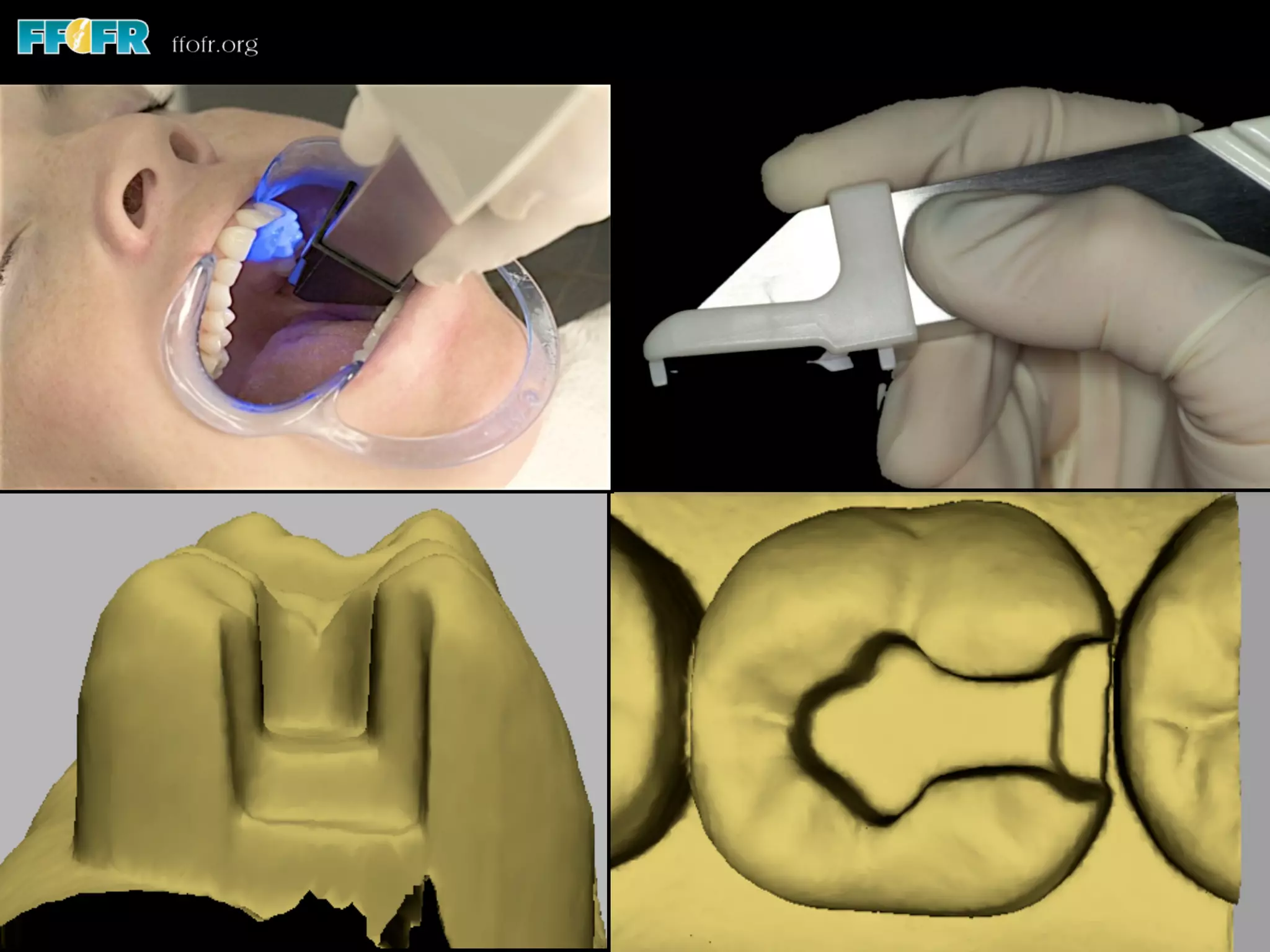 6. secondary imp materials | PDF