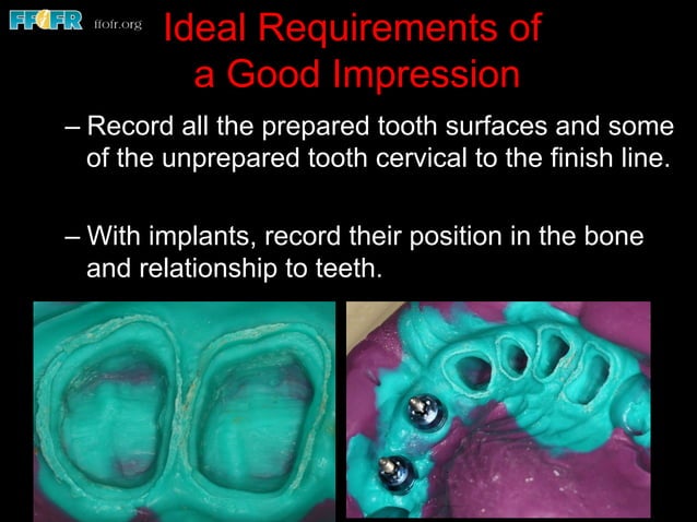 6. secondary imp materials | PDF | Dental Health | Diseases and Conditions