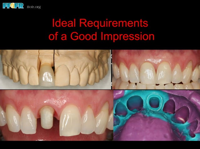 6. secondary imp materials | PDF | Dental Health | Diseases and Conditions