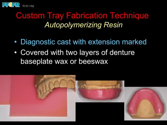 6. secondary imp materials | PDF | Dental Health | Diseases and Conditions