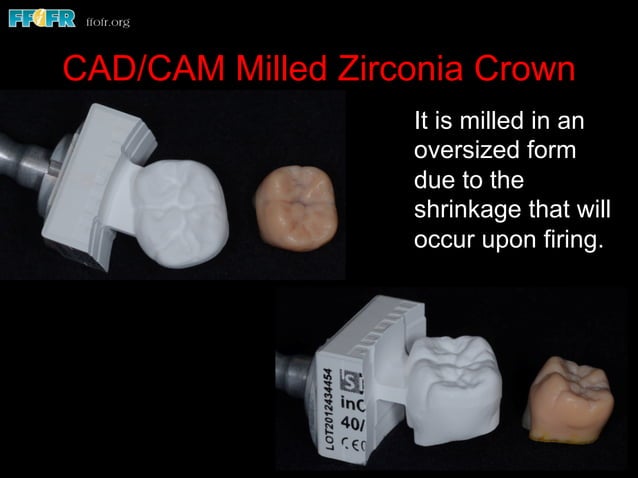 6. secondary imp materials | PDF | Dental Health | Diseases and Conditions