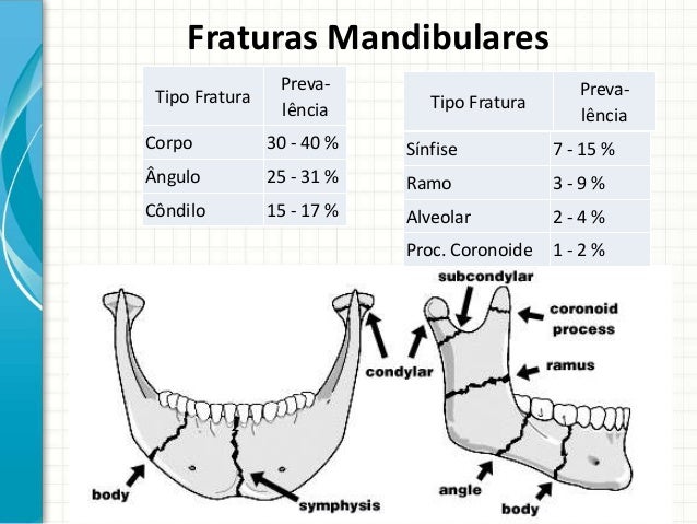 6. aula patrícia juan sobre trauma de face