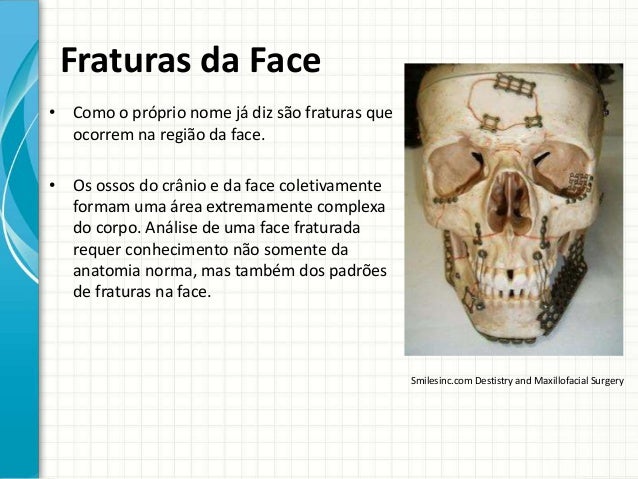 6. aula patrícia juan sobre trauma de face