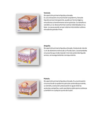 Lesiones de la mucosa oral | DOCX