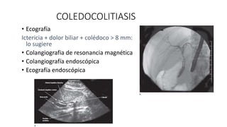 Patología quirúrgica biliar | PPTX
