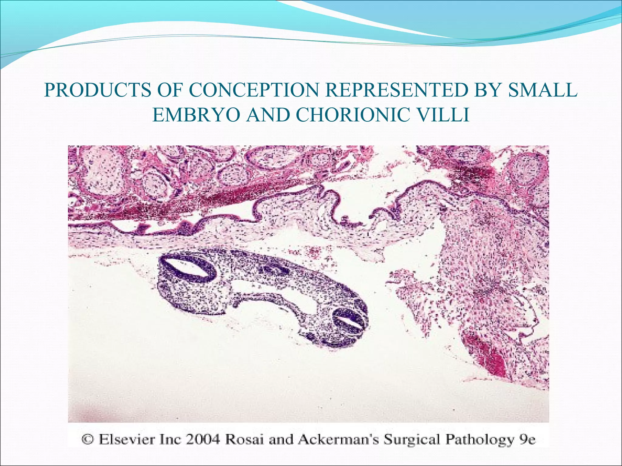Disorders of pregnancy and placental pathology | PPT