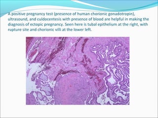 Chorionic Villi Histology