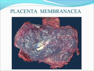 Placenta Membranacea