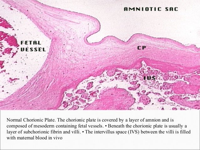 Disorders of pregnancy and placental pathology