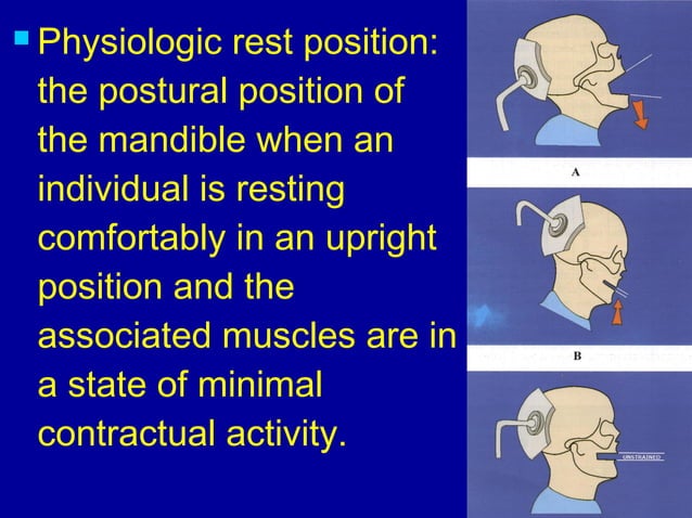 maxillomandibular relations - terminology | PPT | Dental Health ...