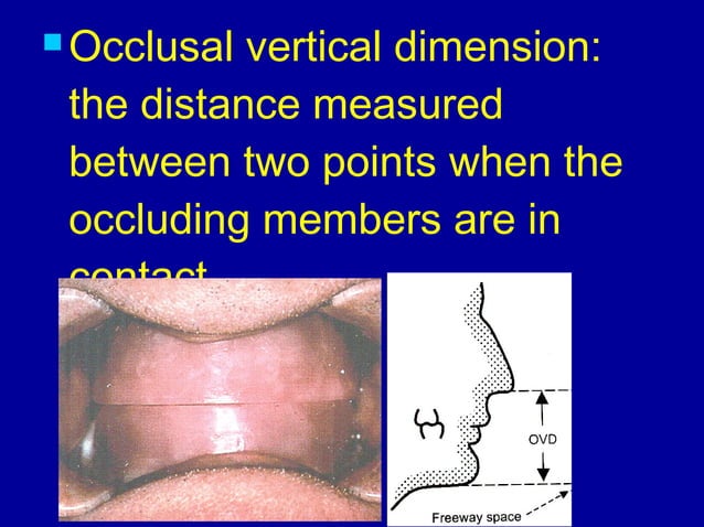 maxillomandibular relations - terminology | PPT | Dental Health ...