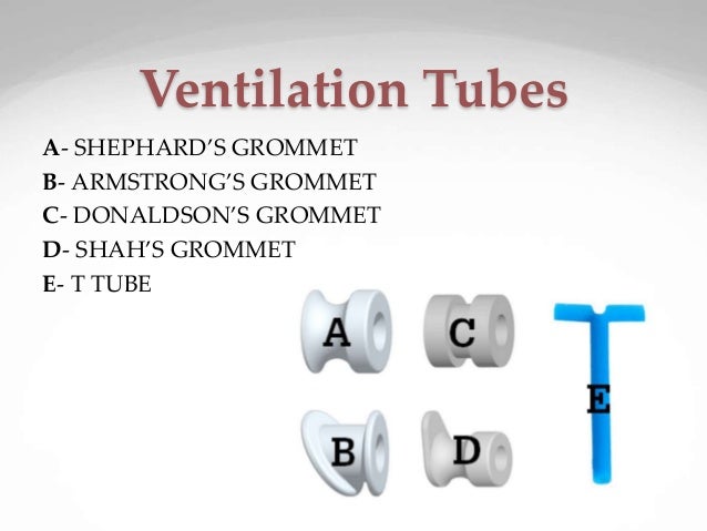OME-Otitis Media with effusion in children