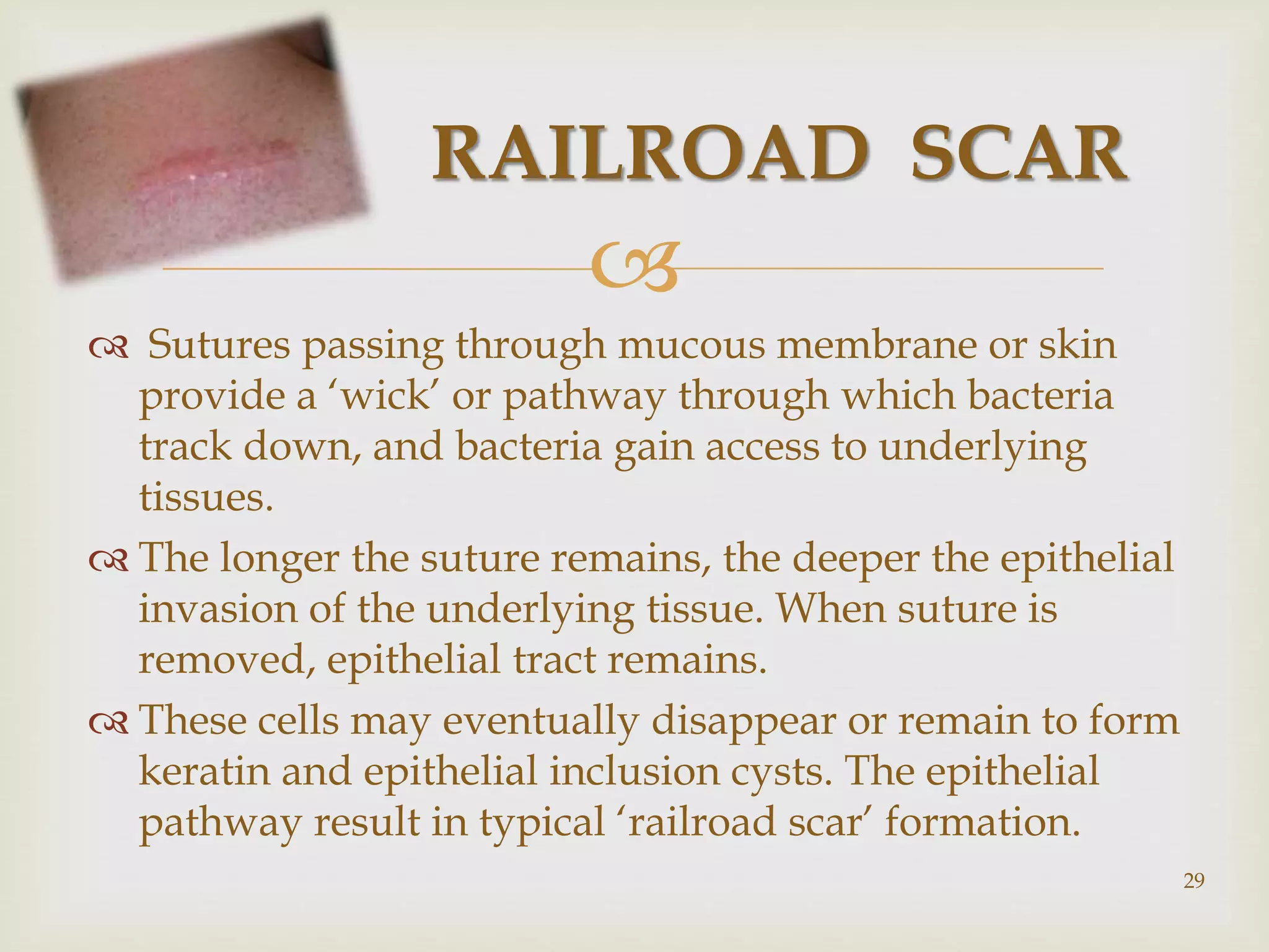 SUTURES AND SUTURING | PPTX