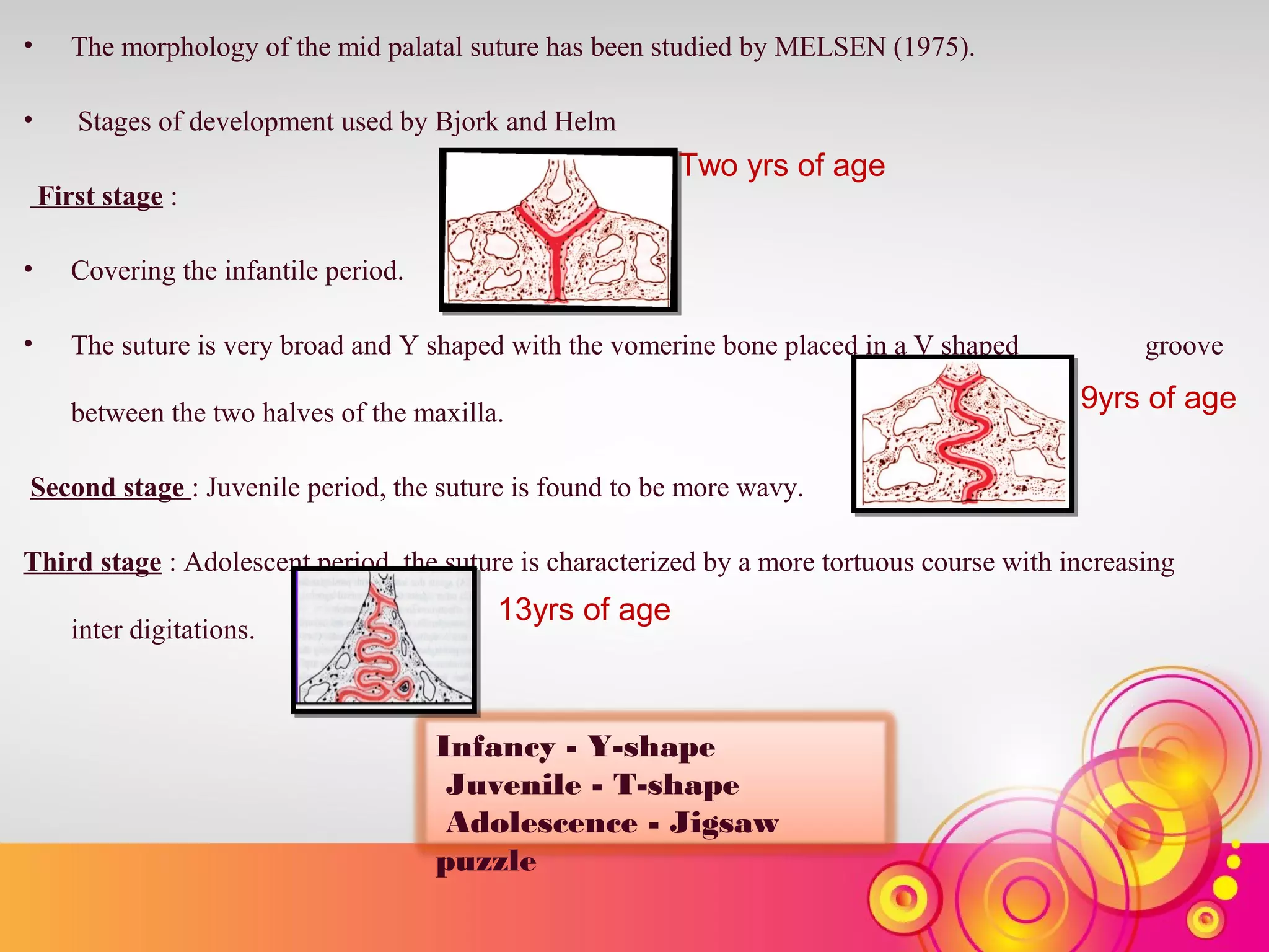 hygenic rapid maxillary expansion in orthodontics | PPT