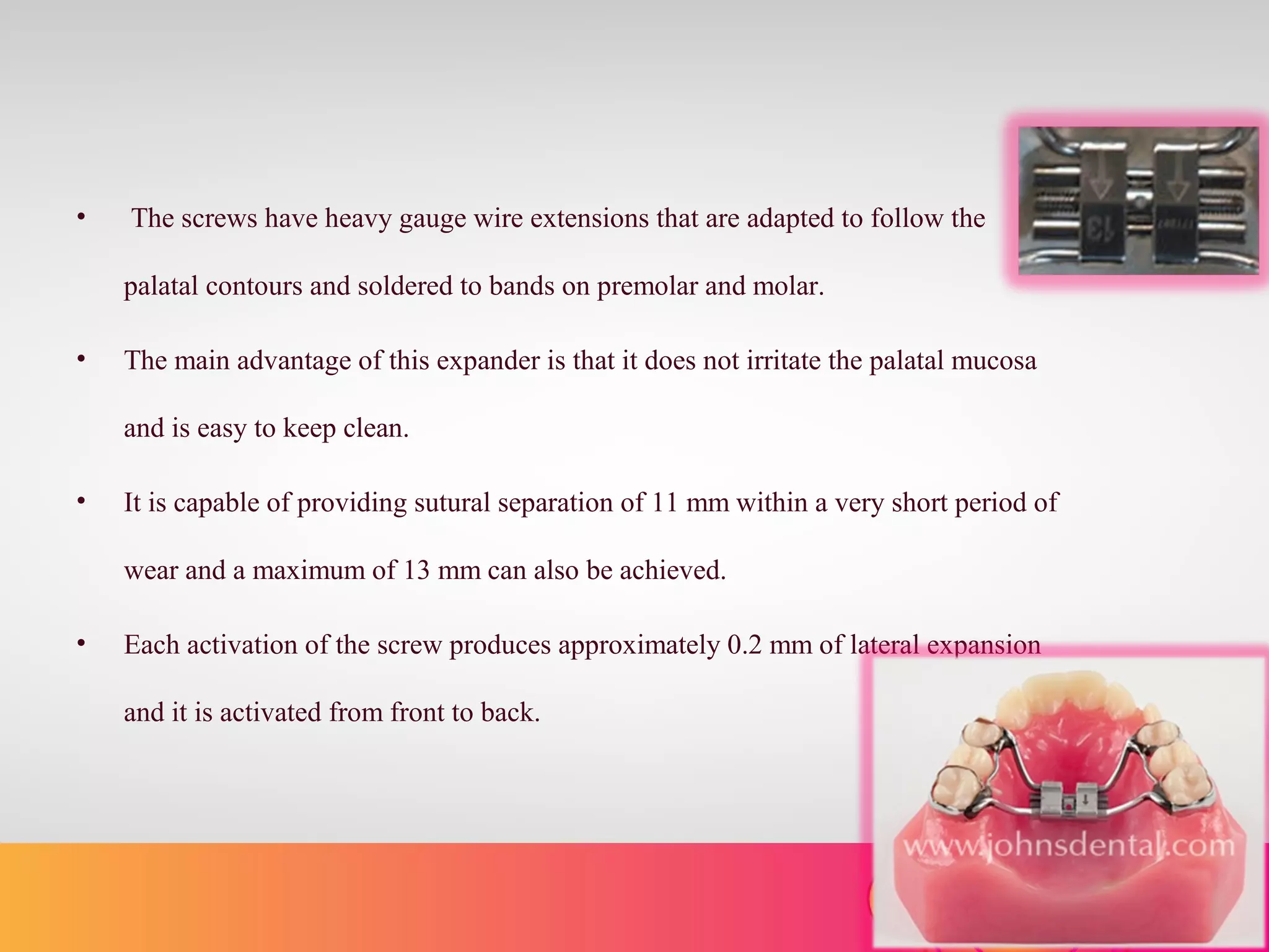 hygenic rapid maxillary expansion in orthodontics | PPT