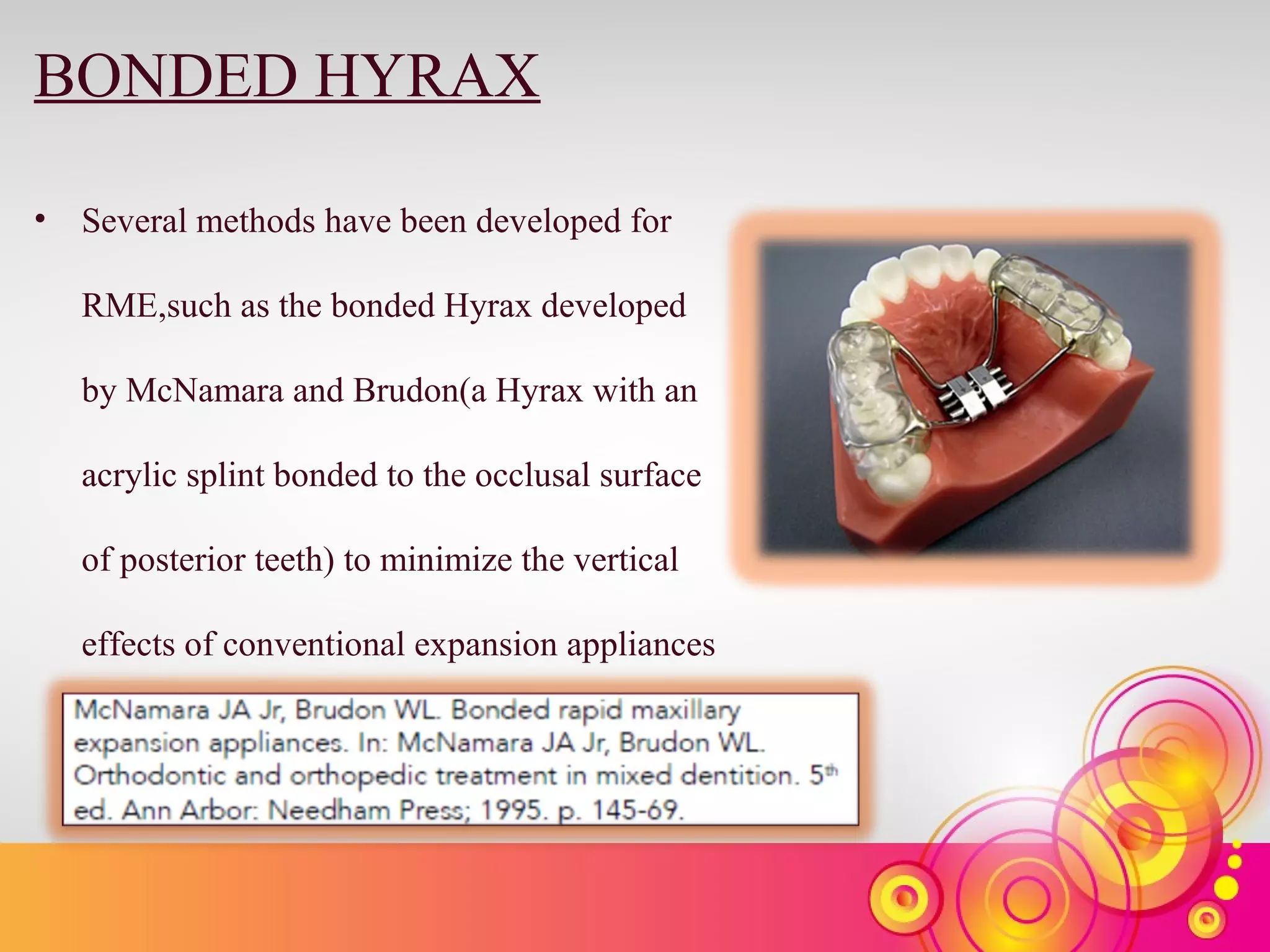 hygenic rapid maxillary expansion in orthodontics | PPT