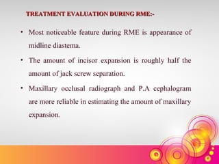 hygenic rapid maxillary expansion in orthodontics | PPT