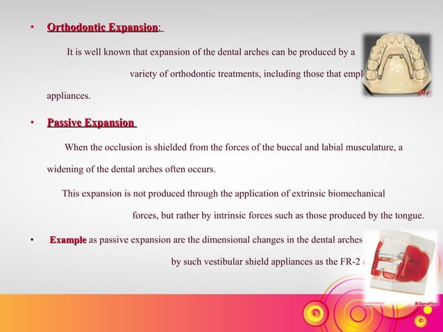 hygenic rapid maxillary expansion in orthodontics | PPT
