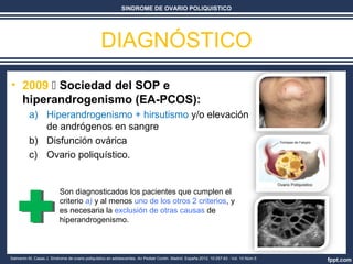 Sindrome de Ovario Poliquisitico (SOP) | PPT