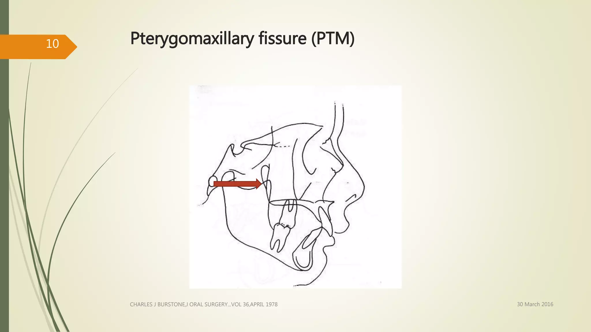 Cephalometric Analysis for Orthognathic Surgery | PPTX
