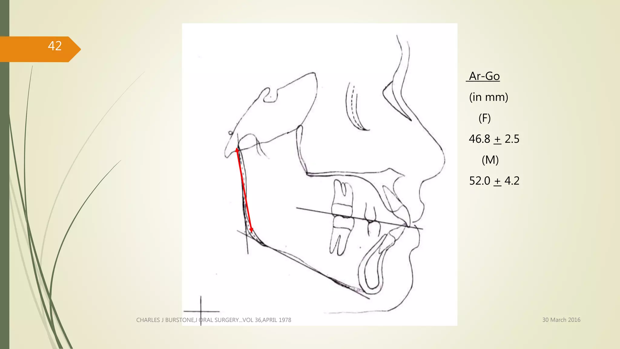 Cephalometric Analysis for Orthognathic Surgery | PPTX