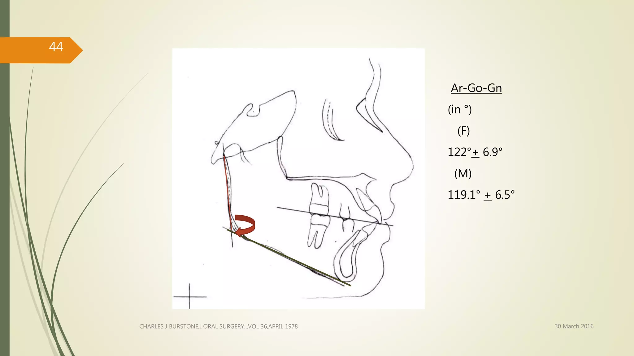 Cephalometric Analysis for Orthognathic Surgery | PPTX