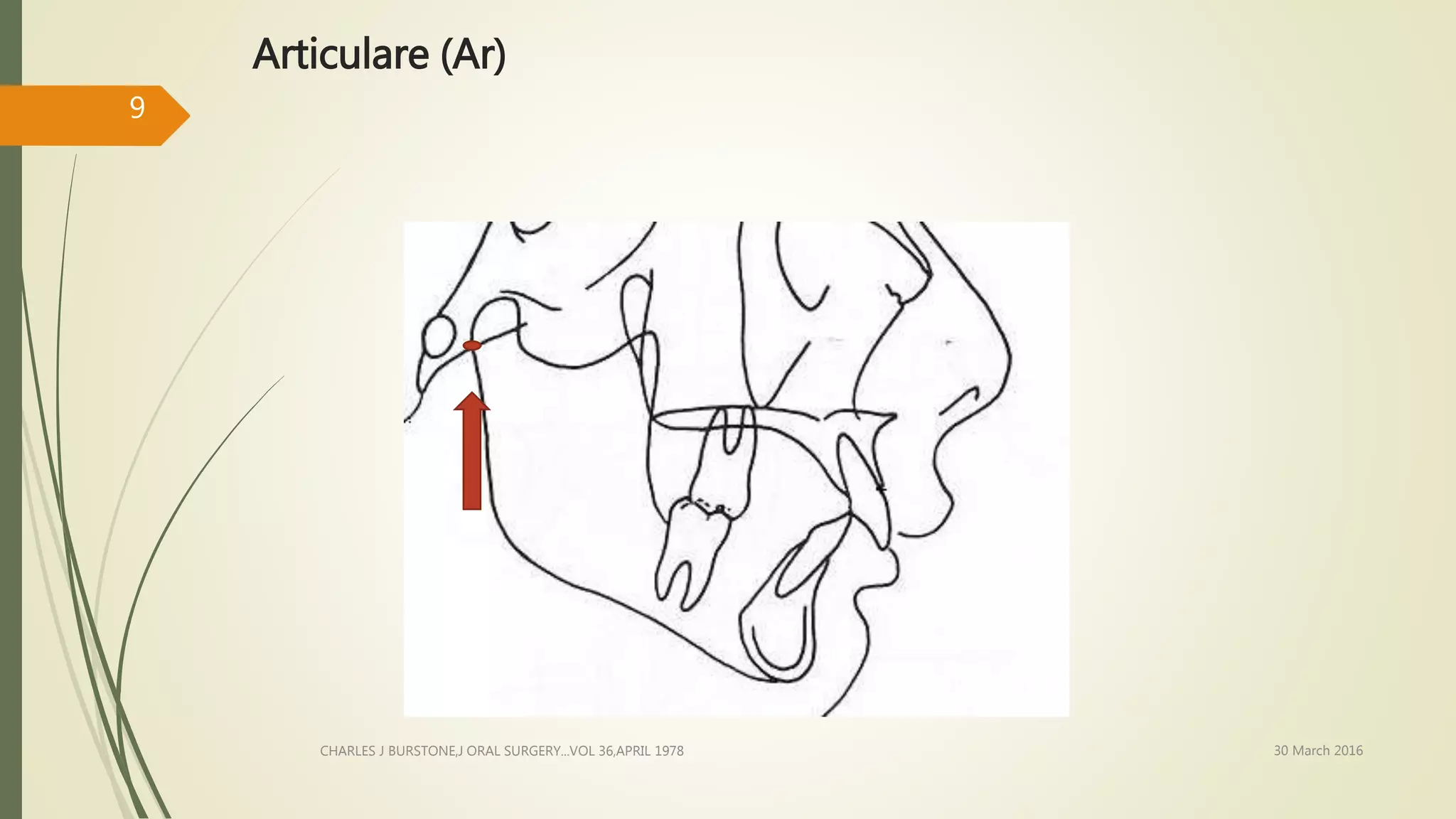 Cephalometric Analysis for Orthognathic Surgery | PPTX