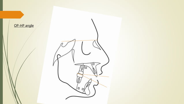 Cephalometric Analysis for Orthognathic Surgery | PPTX | Ear, Nose and ...