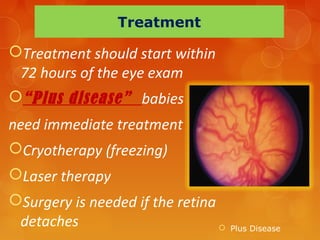 RETINOPATHY OF PREMATURITY | PPT