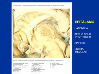 Anatomía y Fisiología del Cuerpo Estriado - AVC | PPTX