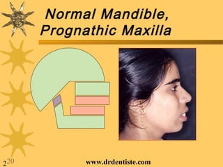 diagnosis & treatment planning | PPT