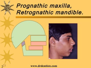 diagnosis & treatment planning | PPT