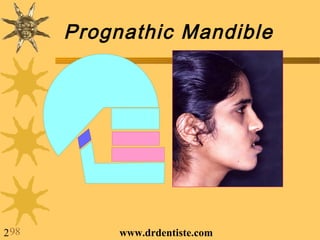 diagnosis & treatment planning | PPT