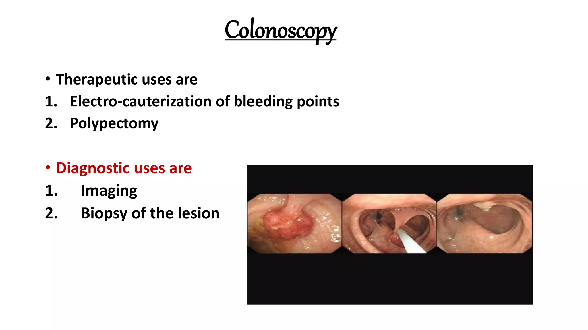 LOWER GI BLEEDING | PPTX