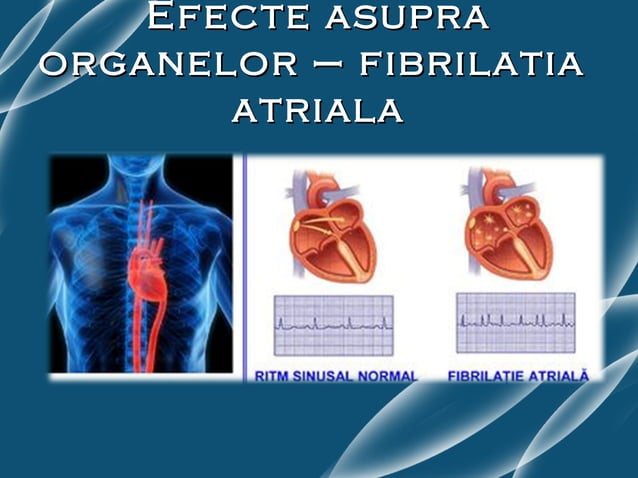 6. avram daria xe-efectul fiziologic al curentului | PPT