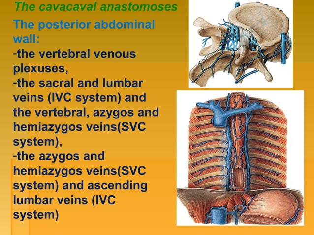 Anatomy of Blood vessels of abdomen pelvic cavities. Portacaval ...
