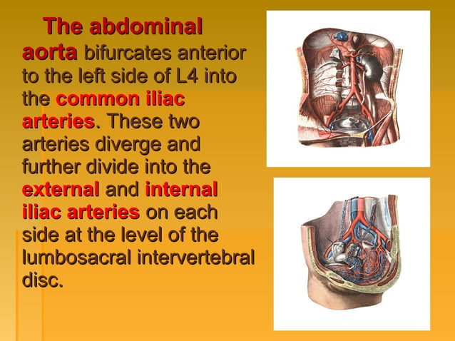 Anatomy of Blood vessels of abdomen pelvic cavities. Portacaval ...