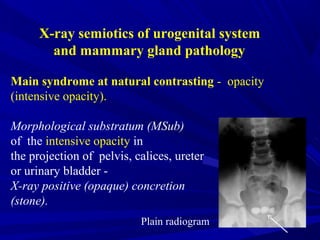 Radiological diagnostics of Urinary System | PPT