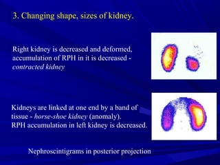 Radiological diagnostics of Urinary System | PPT