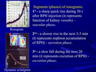 Radiological diagnostics of Urinary System | PPT