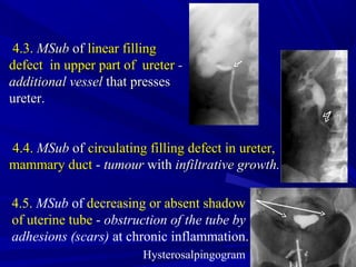Radiological diagnostics of Urinary System | PPT