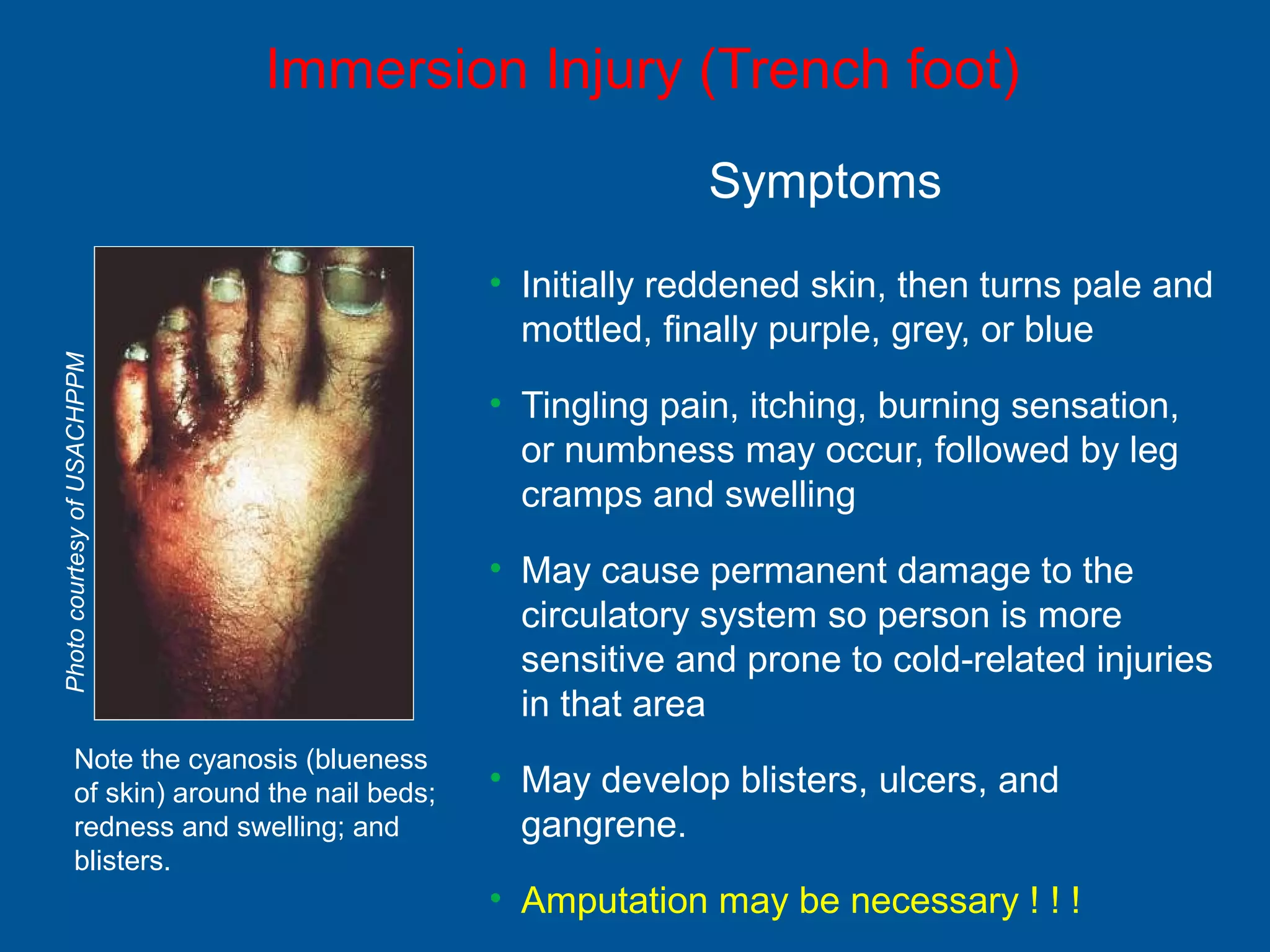 Cold Related Injuries. Hypothermia, Frostbite & Trench foot | PPT