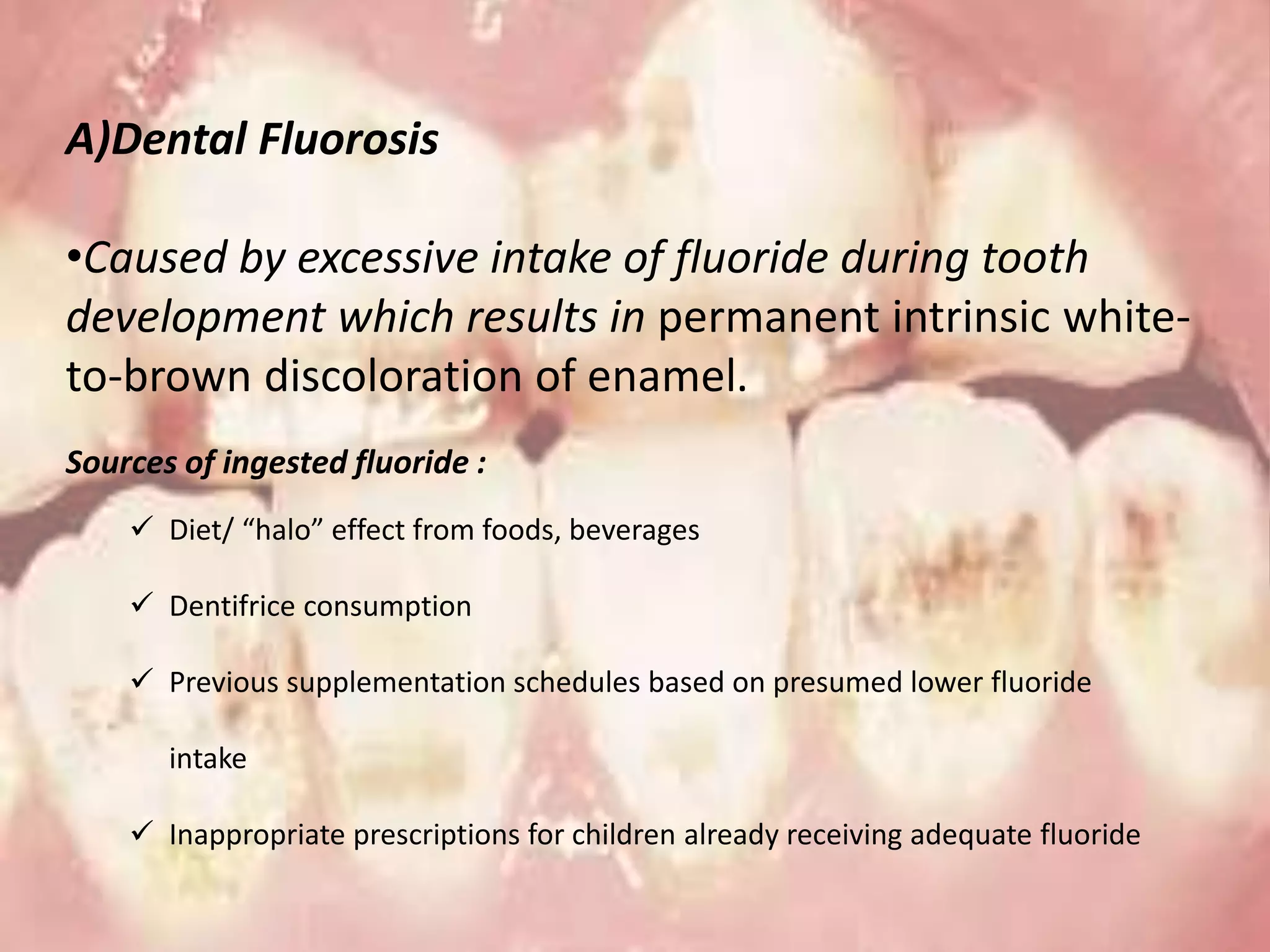 fluoride toxicity | PPTX