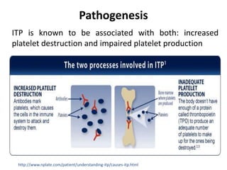 Immune Thrombocytopenic | PDF