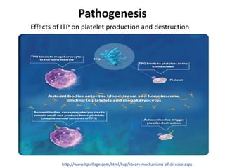 Immune Thrombocytopenic | PDF
