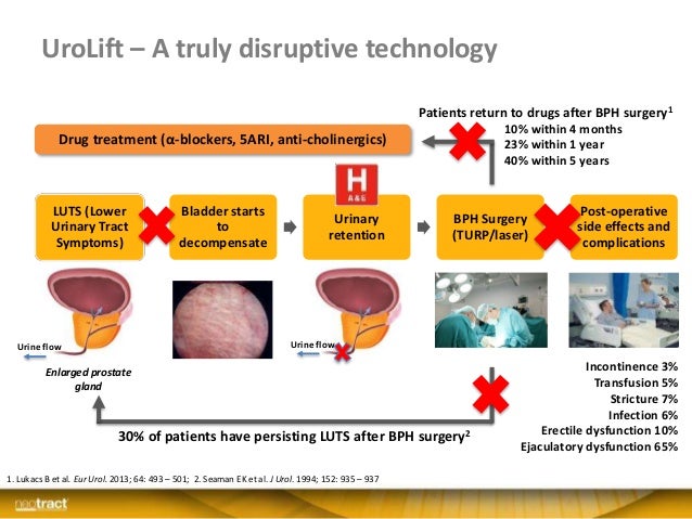 Justin Hall, Urolift
