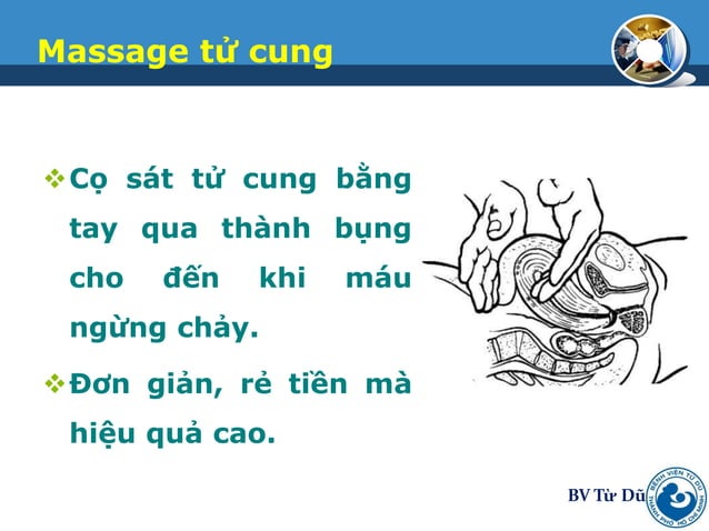 BĂNG HUYẾT SAU SINH | PDF