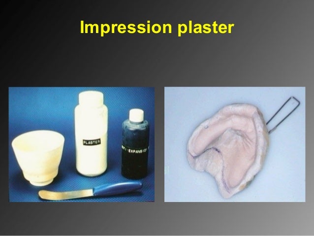 6.impression materials and techniques 1