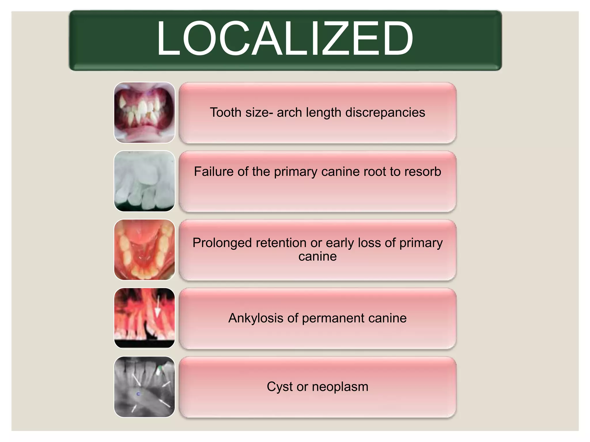 orthodontic management of impacted canine. | PPTX