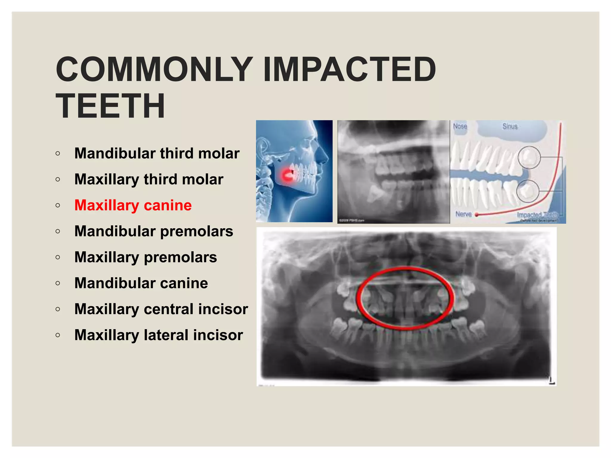 orthodontic management of impacted canine. | PPTX